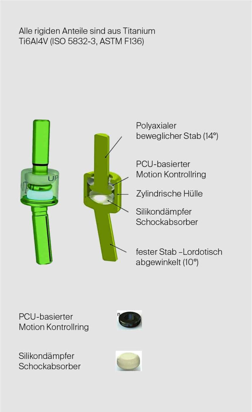 Dynamische Stabilisierung der lumbalen Wirbelsäule - DPV
